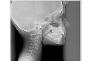 Cefálica Lateral – ORTODIAGNOSTICO